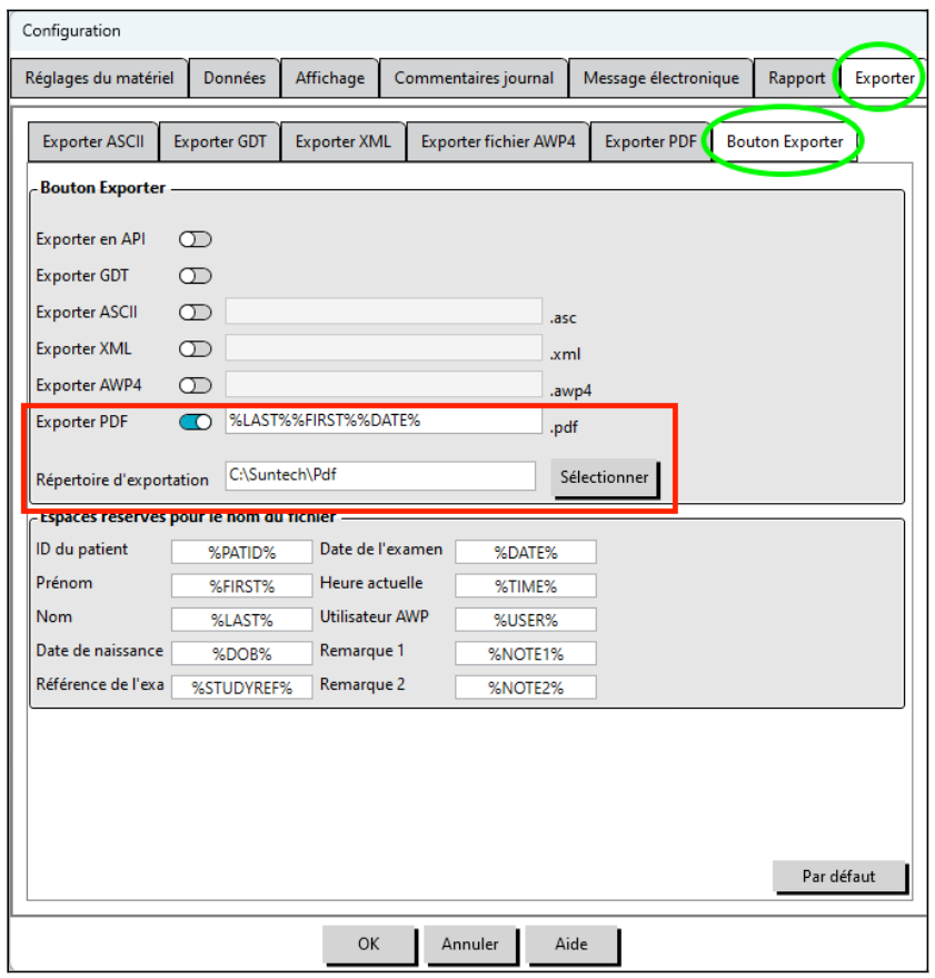 Intégration du logiciel Agilis Mini de MICROPORT / SORIN / ELA ...